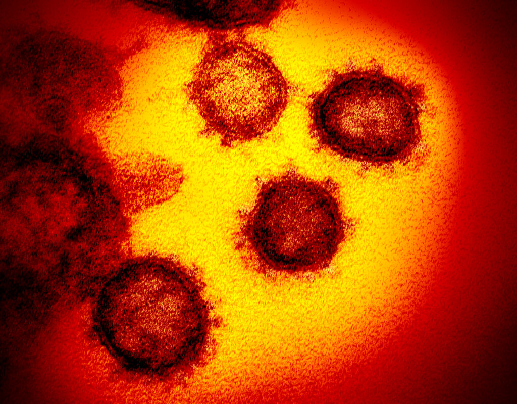 US OKs 1st coronavirus test that allows self-swab at home | News ...